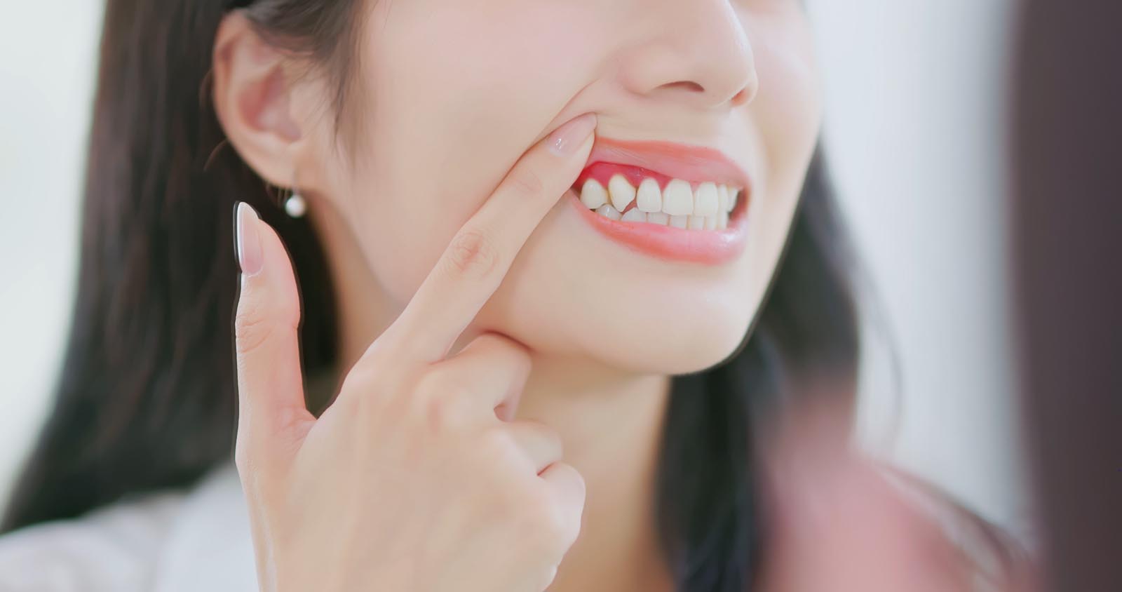 Understanding the Stages of Gum Disease - Dinwiddie Dental